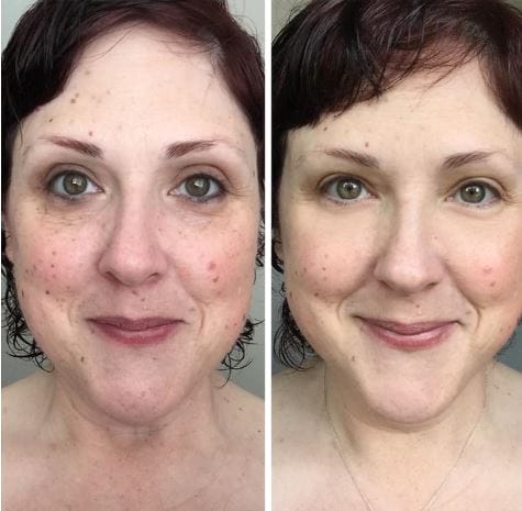 10 Skin Transformation Remedies That You Can Make It At Home In A ...