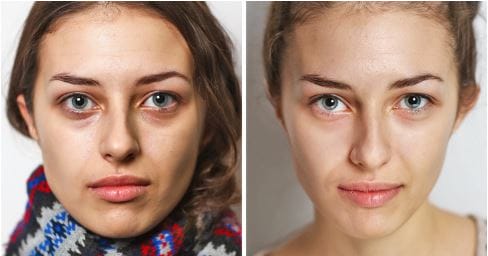 10 Skin Transformation Remedies That You Can Make It At Home In A ...