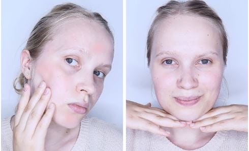 10 Skin Transformation Remedies That You Can Make It At Home In A ...