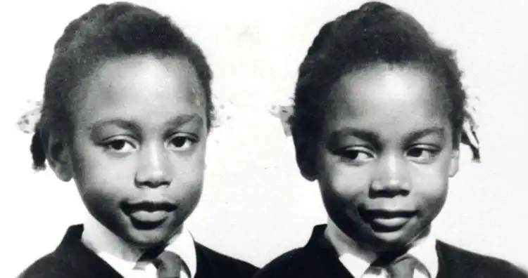 9 Strange Twin Stories You Won't Believe But Are Actually True! - Genmice